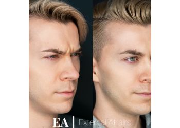 3 Best Med Spa in St. Albert, AB - Expert Recommendations